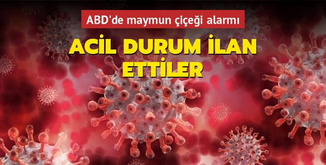 ABD'de maymun çiçeği alarmı... Acil durum ilan ettiler ABD'de maymun çiçeği alarmı... Acil durum ilan ettiler