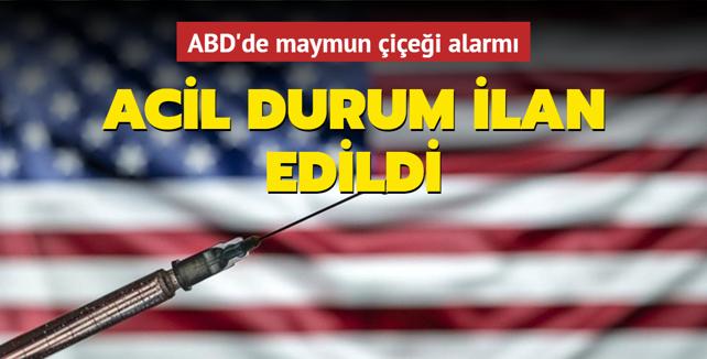 ABD'de maymun çiçeği alarmı... Acil durum ilan edildi ABD'de maymun çiçeği alarmı... Acil durum ilan edildi