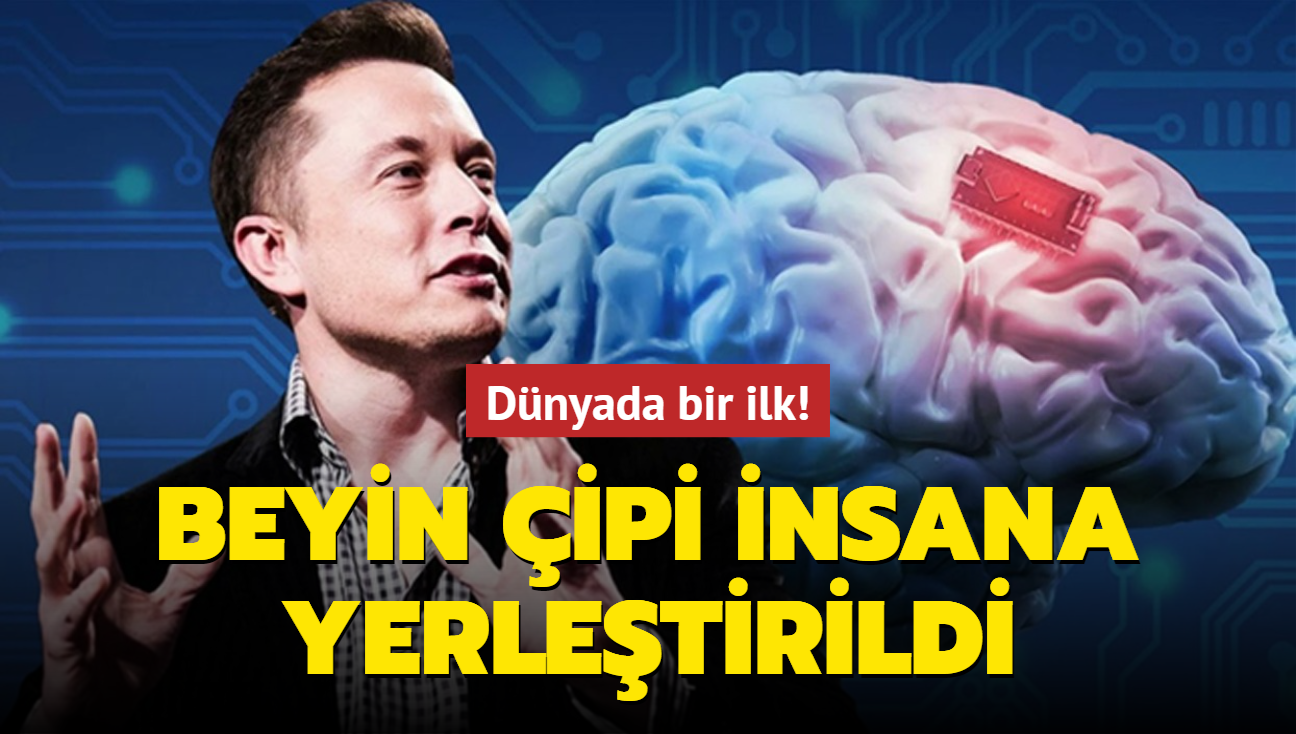 Dünyada bir ilk! Beyin çipi insana yerleştirildi