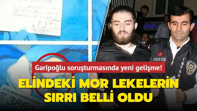 Cem Garipoğlu'nun elindeki mor lekelerin sırrı belli oldu
